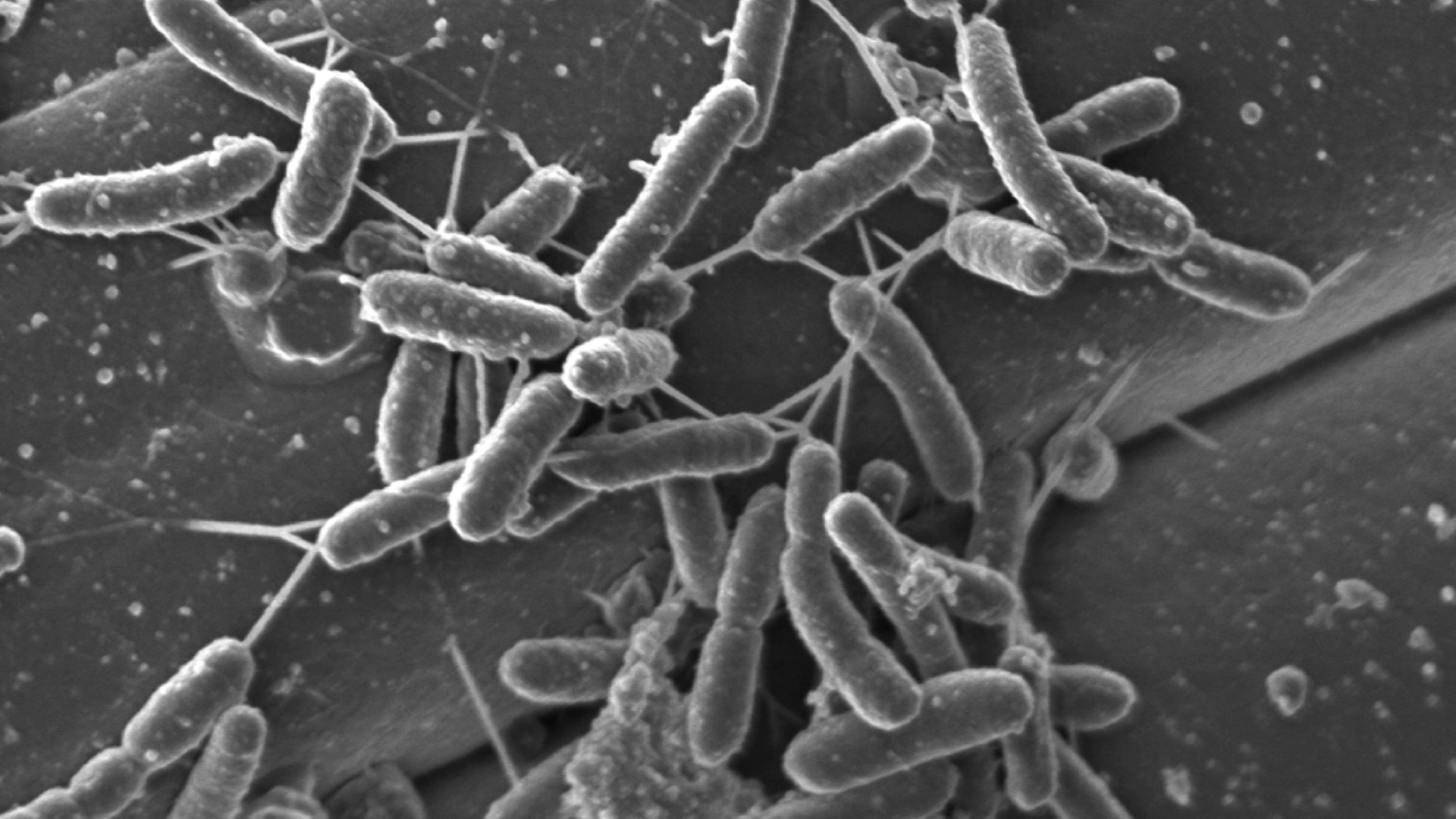 電気をつくる菌、食べる菌 研究進む！電気微生物の世界 – テレビ番組 | WAC ワック